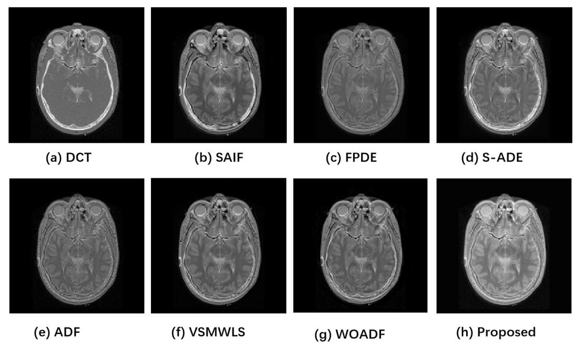 A Multi Modal Medical Image Fusion Framework Based On Two Scale Decomposition And Saliency Detection