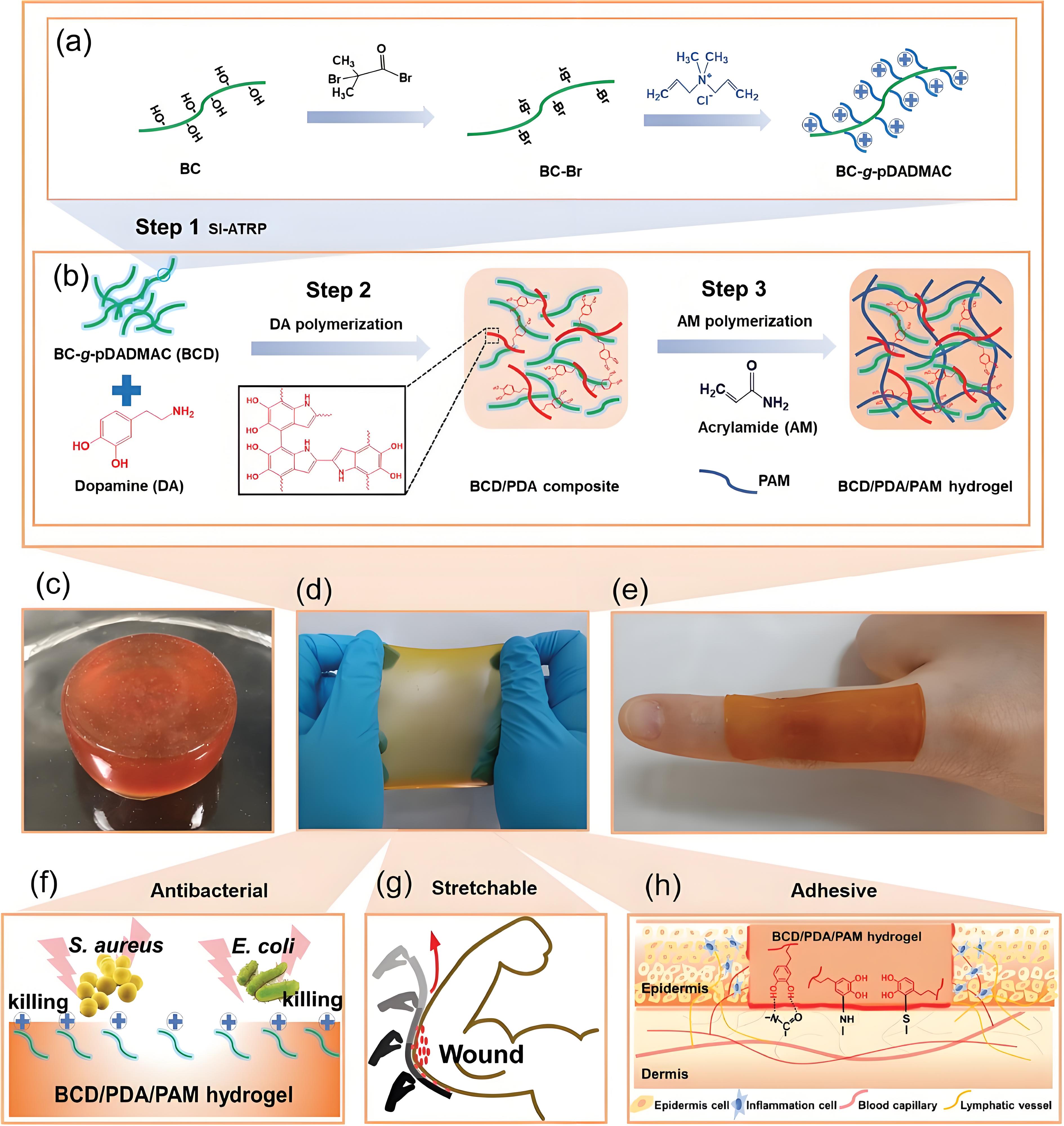 The gel effect: Enhancing diabetic foot ulcer healing through hydrogel ...